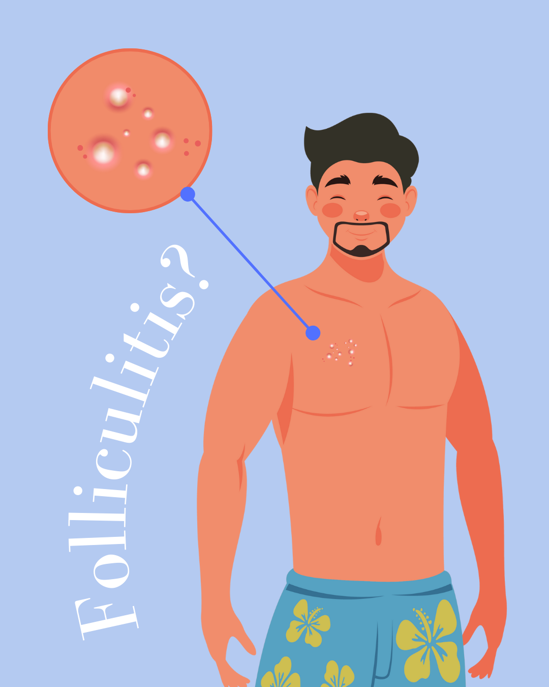 Understanding Waxing and Folliculitis: Prevention and Treatment - pampernpores-com